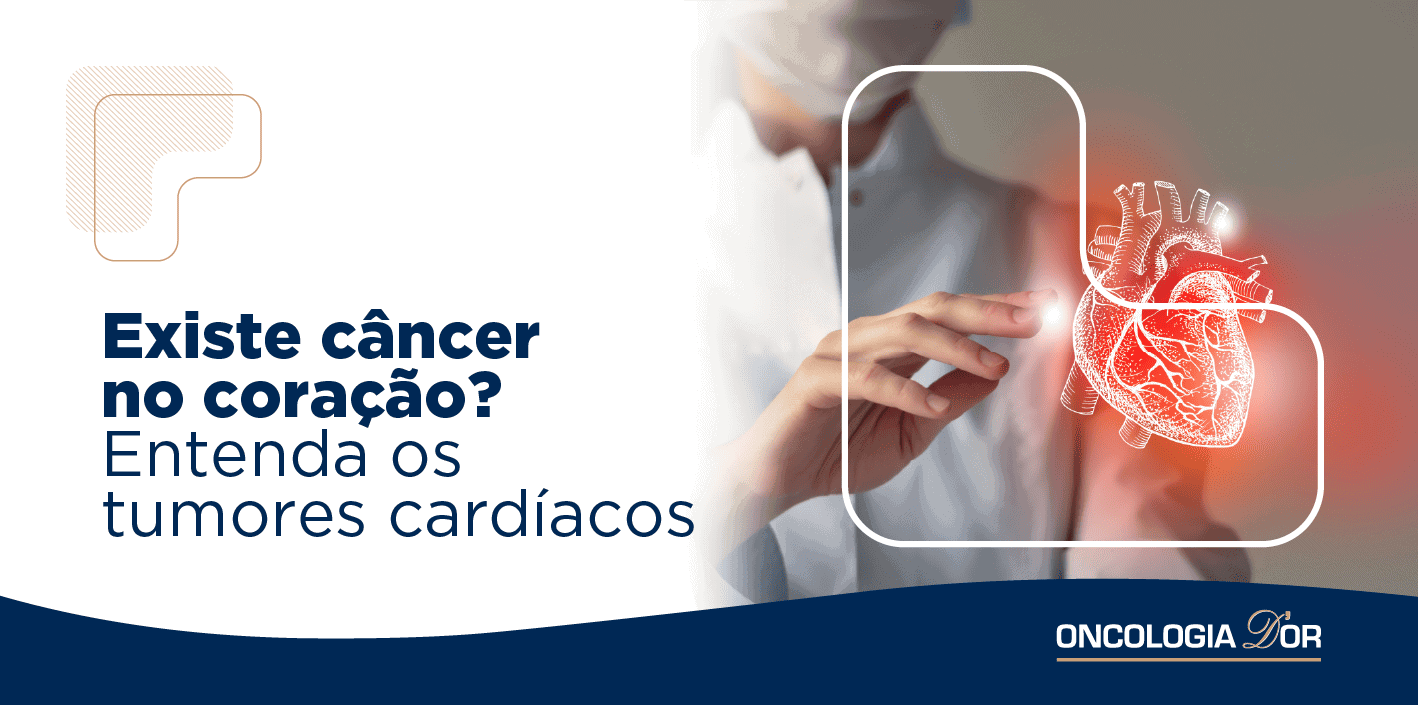 Existe câncer no coração? Entenda os tumores cardíacos - Oncologia D'Or