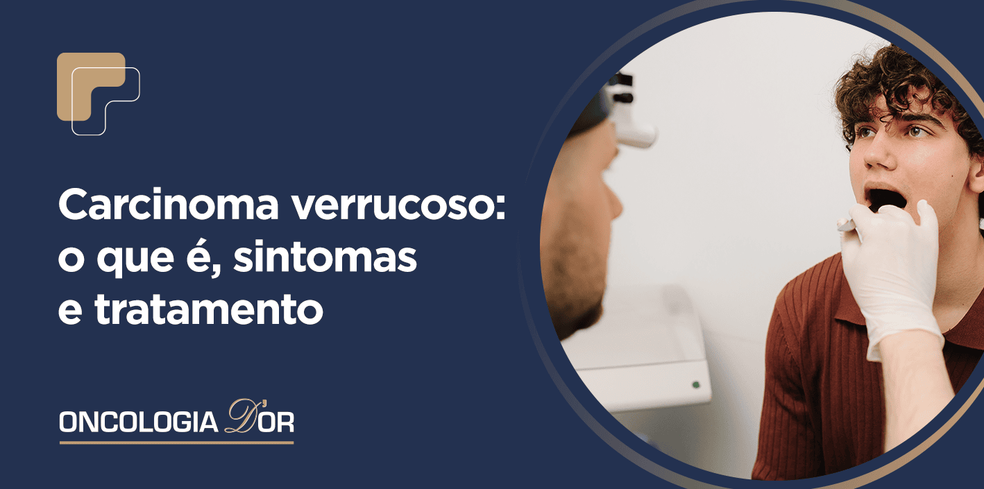 O que é HPV, quais os sintomas e para que serve a vacina? - Oncologia D'Or