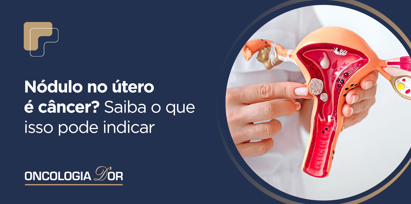 Todo tumor ou nódulo é câncer? - Oncologia D'Or